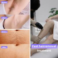 China 808 Diode Laser Ice Hair Removal Machine 4 Wavelengths 1064nm Changeable Spot Size Android System for sale