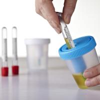 China Medical Labs Clinical Laboratory Accessories Disposable Plastic Urine Container With Needle for sale