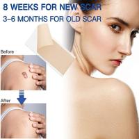 China skin friendly medical silicone dressing silicone gel scar patches for scars for sale