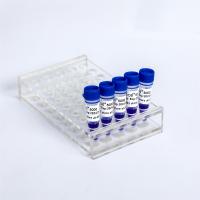 China GDSBio Pre Staining Gel LD DS 5000 DNA Marker Electrophoresis Blue LM1111 LM1112 for sale