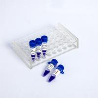 China Nucleic Acid Dye LD DS 5000 DNA Marker Electrophoresis Ladder LM111 for sale