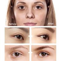 China ODM Pro Xylane Eye Cream For Dark Circles And Puffiness Customized for sale
