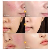 China MSDS Facial Skin Care Products Organic Chamomile Petals Serum Natural Facial Serum For Sensitive Skin for sale