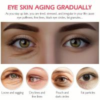 China 20g Eyecare Cosmetics Protein Firming And Lightening Fine Lines Moisturizing Eye Cream for sale
