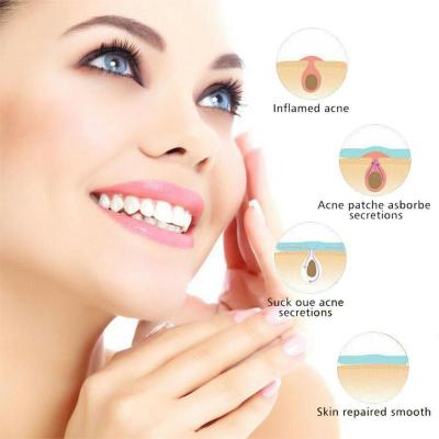 China Vegan Friendly Hydrocolloid Acne Pimple Patch For Covering Zits for sale