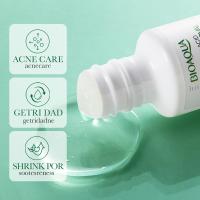 China 30ml Anti Acne Face Serum Organic Acne Treatment Salicylic Acid Pimple Removal Facial Skincare for sale