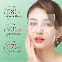 China OEM Salicylic Acid Acne Mask Shrink Pores Brightening Moisturizing Facial Sheet Mask for sale