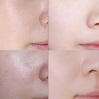 China 30g Ultimate Spot Cream Acne Treatment Brighten And Repair Face Cream for sale