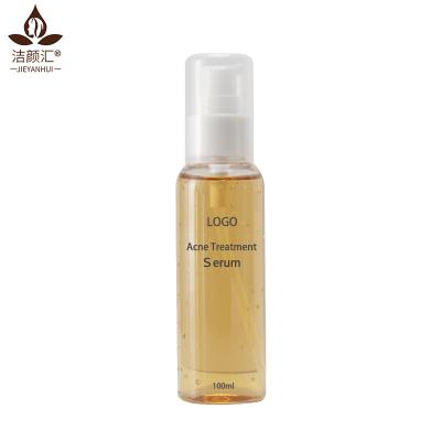 China OEM Salicylic Acid 2% Acne Care Solution Facial Serum For Smoother Clearer Skin for sale