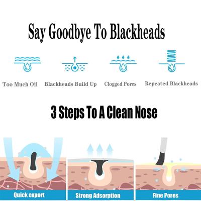 China 500ml OEM Skin Care Products Acne Shrink Coarse Pores Beauty Salon Blackheads Liquid Remover For Nose for sale