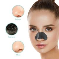 China OEM Skin Care Products 5pcs Deep Cleansing Bye Bye Blackhead Removal Nose Strips for sale