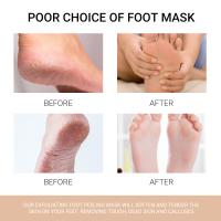 China 40ml Juice Peach Foot Peel Mask Deep Moisturizing Exfoliating Socks for sale