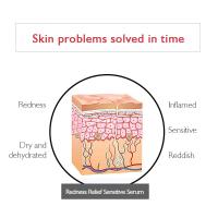 China Oem Private Label Organic Anti-Redness Serum For Reducing Redness Facial Serum for sale