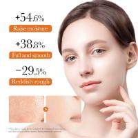 China 50G Turmeric Facial Cream Skin Care Whitening Acne Treatment Face Cream for sale