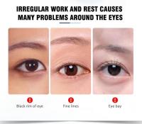 China 15ml OEM Skin Care Products Revitalizing Anti Aging Eyebag Removal Eye Cream for sale