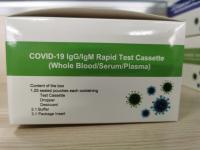 China 13*100mm Rapid Virus Sampling Diagnostic Test Kit for sale