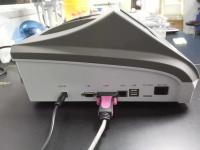 China Portable POCT Fluorescence Immunoassay Whole Blood Plasma for sale