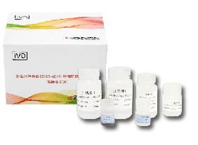 China Viral Nucleic Acid Extraction Kit 36 Tests 48 Tests 96 Tests Magnetic Bead Method High Recovery for sale