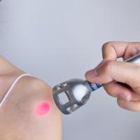 China 1064nm Laser Physiotherapy Machine 15W Pulse Continuous Operation for Pain Relief for sale