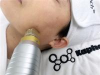 China 10.4 Inch Fractional RF Microneedling Machine with Thermal Cooling for Face Lifting 180W for sale