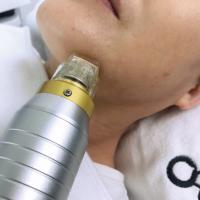 China Touch Screen Microneedling Fractional RF Skin Rejuvenation 0.2mm Needle 180W for sale