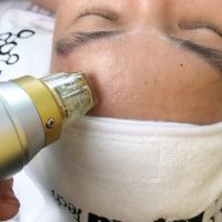 China Touch Screen Microneedling Fractional RF Skin Rejuvenation 0.2mm Needle 180W for sale