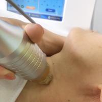 China 10.4 inch Touch Screen RF Microneedle Machine Thermal Cooling Scar Reduction Machine for sale