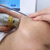 China 4 Hands Deep Heat Microneedling Fractional RF Beauty Facial Machine 180W 0.2-3mm for sale