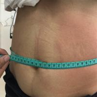 China 80Kpa Cool Sculpting Cryolipolysis Fat Freezing Machine for sale