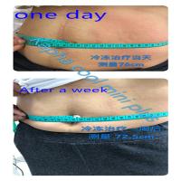 China 80Kpa Cool Sculpting Cryolipolysis Fat Freezing Machine for sale
