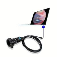 China USB 3.0 Camera Kit Richer Colors Portable Endoscopy Machine For Mac PC ENT Examine for sale