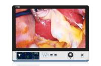 China LN-D27F 27 Inch Medical Endoscope Camera System 1080P 60FPS Sony CMOS Noise Reduction for sale
