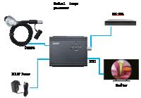 China LN-23YL 2M Medical Image Processor 1080P 60FPS Sony CMOS for Endoscopy for sale