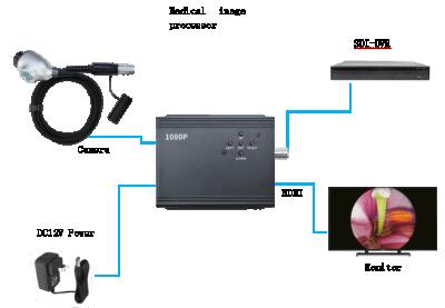 China Portable 2-Output Endoscope Image Processor 1080P 60FPS Sony CMOS 120g for sale