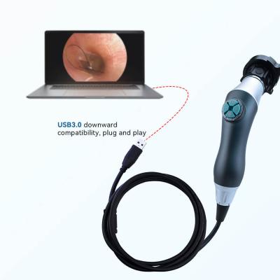 China USB Handheld ENT Endoscope 1080P SONY CMOS Sensor 2MP 200g Ergonomic Design for Medical Examination for sale