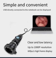 China USB 3.0 Endoscope Camera 5 Gbps High Resolution Color Tuning Medical Imaging for sale