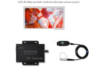 China 4K Endoscope Camera Inspection System 3840x2160P HDMI SDI for Medical Diagnosis for sale