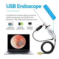 China 1080P 60fps Cold Light Imaging Portable USB Endoscope and Endoscope Camera for ENT Examination for sale