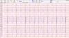 China Mini PC ECG Device Ambulatory ECG Monitoring With Stable Software CE Approval for sale