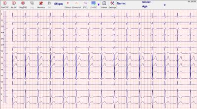 China Heart echo stress test 500Hz , stress ecg test PC and box connecte for sale