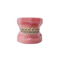 China Dental Typedont Teeth Model For Preparation Dental Student Orthodontic Practice Model for sale