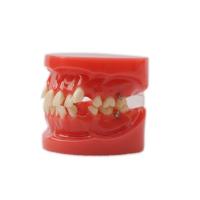 China Training Use Dental Teeth Teaching Model Functional Dental Orthodontic Model Without Bracket for sale