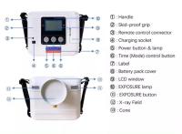 China Portable Dental X Ray Machine Wireless Handheld Dental X Ray Unit with 60kV 2mA and Digital Imaging System for sale