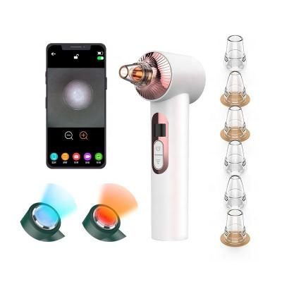 China Microdermabrasion Pore Deep Cleansing Facial Machine Electric Blackhead Remover Vacuum 200g for sale