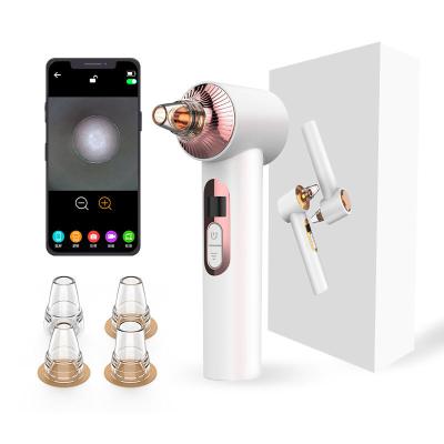 China USB Rechargeable 6 Suction Heads 63kPa Electric Blackhead Extractor Pore Cleaner for sale