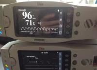 China Masimo Radical 7 Used Pulse Oximeters For Hospital Home Care for sale