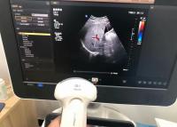 China Philip C5-1 Abdominal Medical Ultrasound Probe For EPIQ 5 device for sale