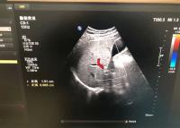 China Philip C5-1 Abdominal Medical Ultrasound Probe For EPIQ 5 device for sale