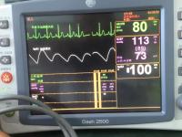 China GE DASH2500 Patient Monitor Repair Maintenance For Medical Field ECG for sale
