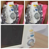 China Philip MP60 MP40 MP50 Patient Monitor Encoder Sillicone Part Original for sale